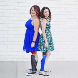 Succeed As An Amputee: Three Steps | BioAdvance Prosthetic Solutions